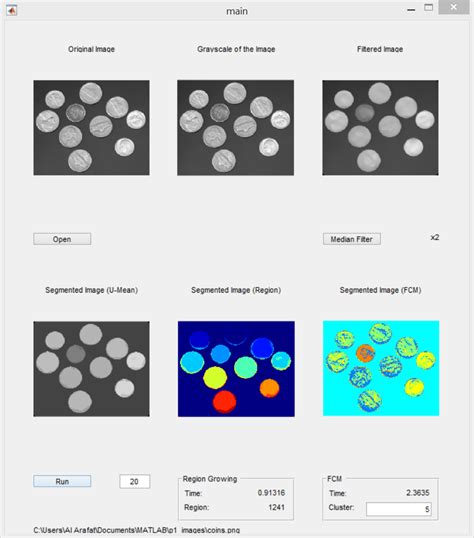 Taner Güngör Image Segmentation Region Growing Algorithm
