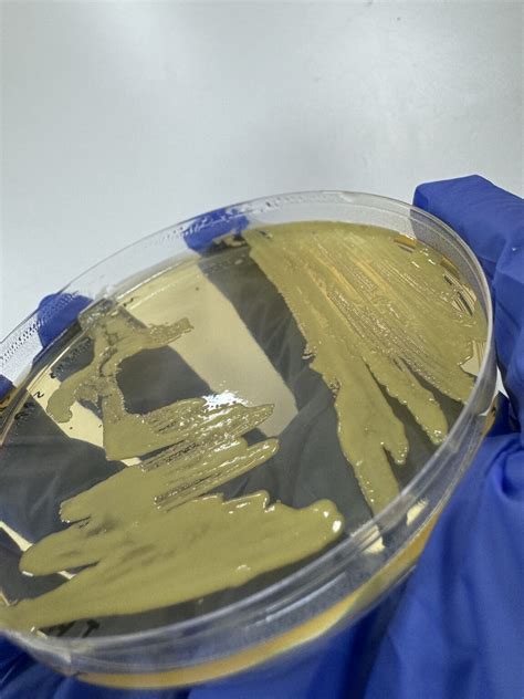 Todays Catch Micrococcus Spp In Bhi Brain Heart Infusion Agar… Dalia D Ikram