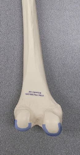 Kin 223 Lab 4 Bone Marking Terms And Examples Flashcards Quizlet