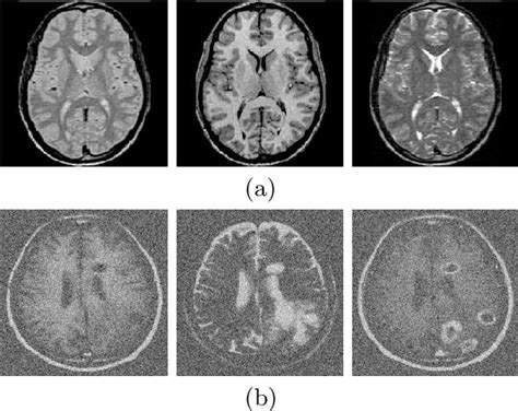 Figure 1 From A Hidden Markov Model For Image Fusion And Their Joint
