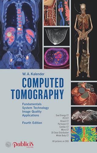 Computed Tomography Fundamentals System Technology Image Quality