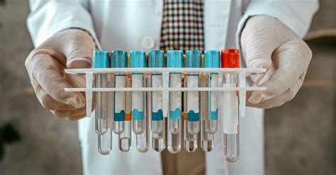 Ace Level Test Purpose Risks And Procedure