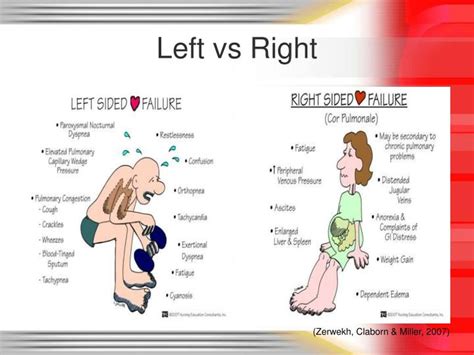 Difference Between Right Sided And Left Sided Heart Failure Compare