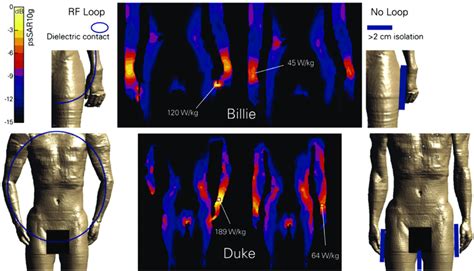 illustration of sar enhancement for billie and duke with and without