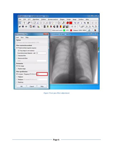 Lung Nodule Detection PDF