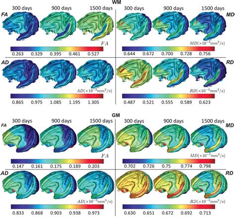 Figure 1 From Diffusion Tensor Imaging Based Characterization Of Brain