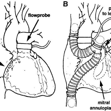 Surgical Preparation Experimental Biventricular Circulation A And
