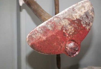 Homem leva dois golpes de enxada na cabeça FOLHAMAX