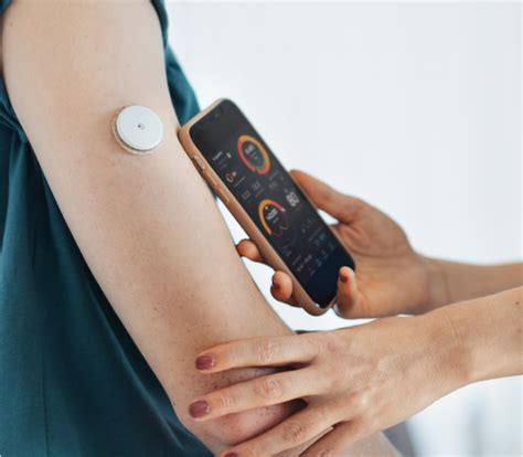 cgm continuous glucose monitor
