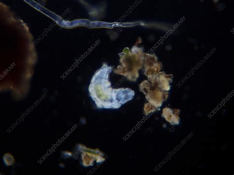 Tardigrade Light Micrograph Stock Image C058 4400 Science Photo