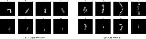 Figure 1 From Model Ensembling A Simple Way Of Improving Model Performance For Chromosome