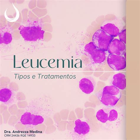 Leucemia Tipos E Tratamentos