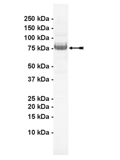 Eurofins Discoverx Mekk2 Protein Active Proteins A Z Proteins