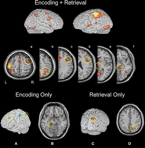 Frontiers Spatial And Temporal Dynamics Of Cortical Networks Engaged In Memory Encoding And