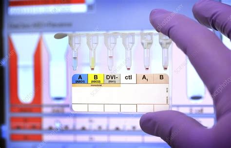 Rhesus Test Recorded On Computer Stock Image C0110329 Science Photo Library