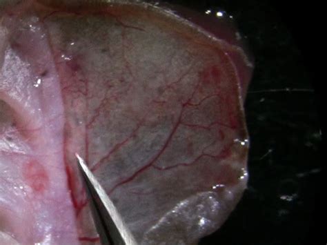 Video Long Term Intravital Immunofluorescence Imaging Of Tissue Matrix