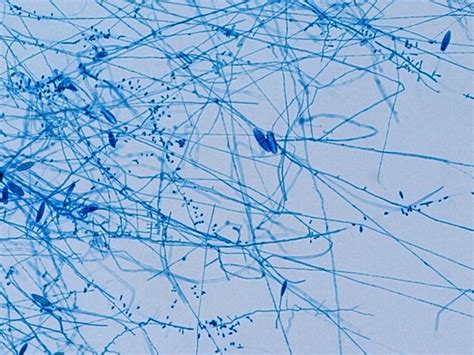Fun With Microbiology Whats Buggin You Microsporum Gypseum