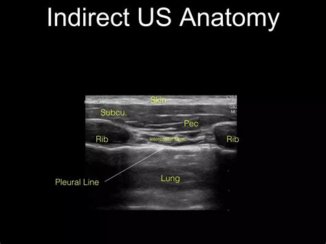 Ultrasound Confirmation Of Ett Placement Ppt