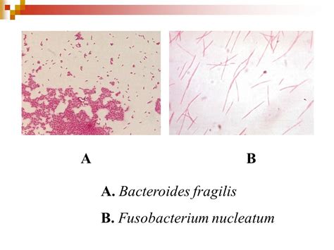 Bacteroides Fragilis Telegraph