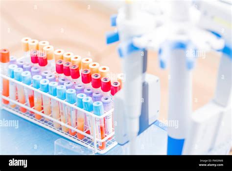 Tubos Vacutainer con muestras de sangre en el laboratorio Fotografía de
