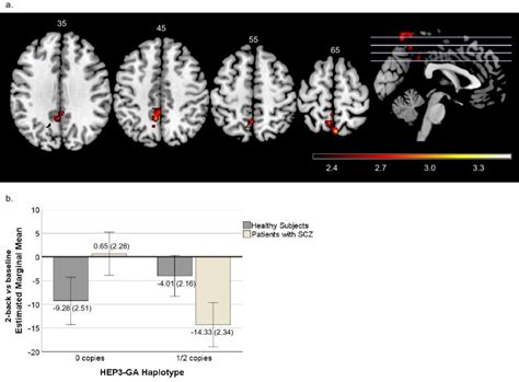 Combining Fmri And Disc1 Gene Haplotypes To Understand Working Memory Related Brain Activity In