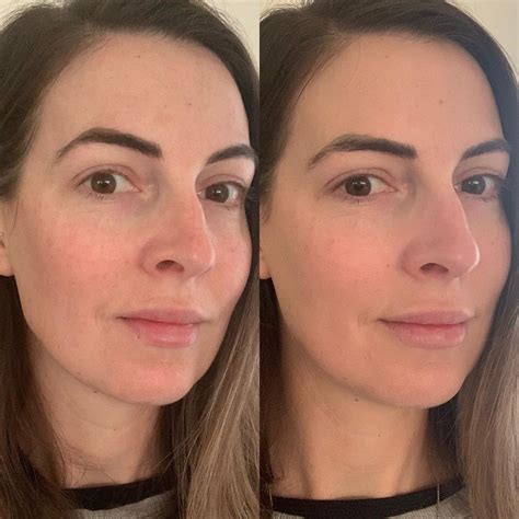 Anti Aging Skin Care Products On Instagram Um Hallo 💃 Skin Tint