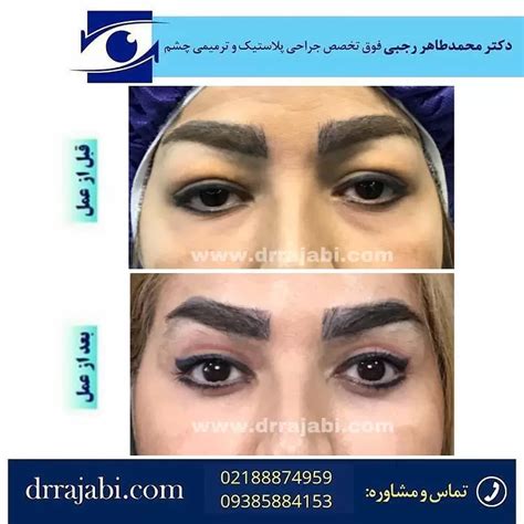 فوق تخصص جراحی پلاستیک چشم پروفسور محمد طاهر رجبی