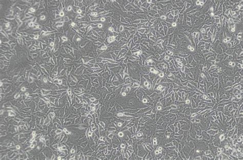 Hela人宫颈癌细胞 Hela人宫颈癌细胞价格表 Hela人宫颈癌细胞使用说明书