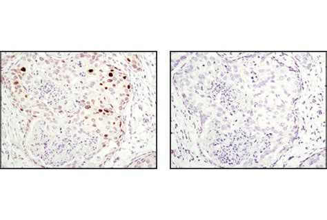 P21 Waf1cip1 12d1 Rabbit Mab Bsa And Azide Free Cell Signaling