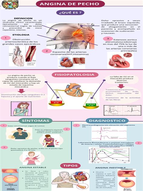 Infografía Sobre Angina De Pecho Pdf Corazón Fisiología