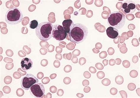 Pin On Oncology Practice