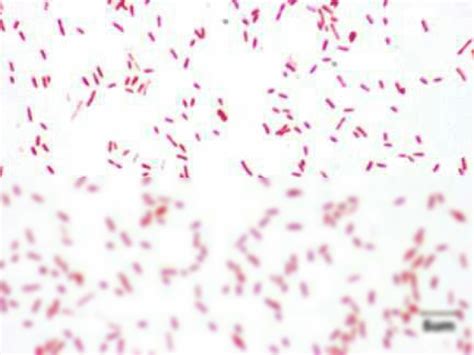 Solution Proteus Spp Studypool