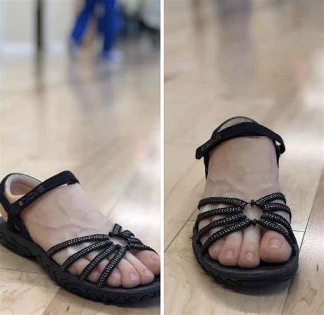 These Sandals You Can Wear If Your Feet Are Looking Particularly Bad