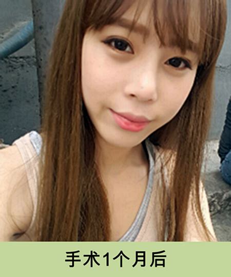 朴美美真实自拍 Id整形医院