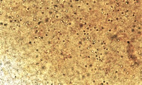Genetic Variability Of The Cryptosporidium Genus State Veterinary