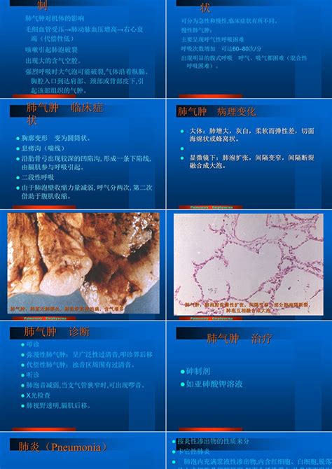 第七章 呼吸系统疾病ppt模板卡卡办公