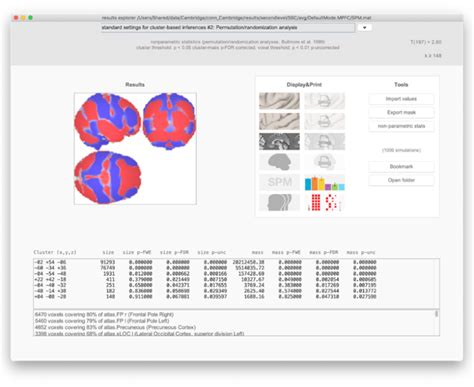 Example Report Of Randomizationpermutation Nonparametric Cluster Level