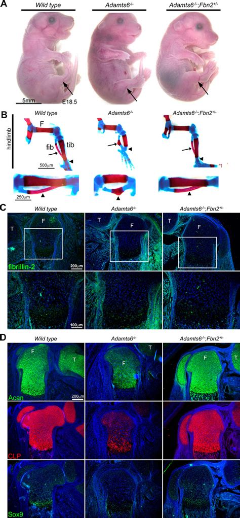 Proteolysis Of Fibrillin 2 Microfibrils Is Essential For Normal Skeletal Development Pmc