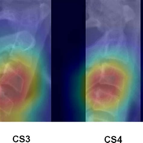 Representative Class Activation Map Of The Correct Classification In