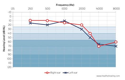Degrees Of Hearing Loss Understanding Your Hearing Test Results