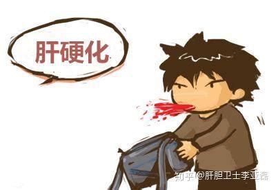 肝硬化出现呕血便血这是为何 知乎