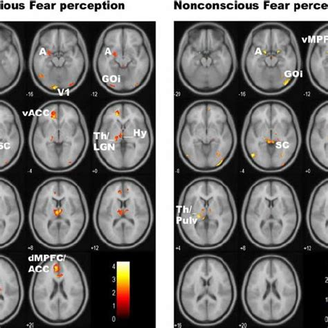 Statistical Parameter Maps For The Regions Of Interest Activated In