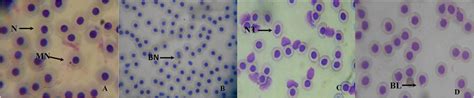 Micronucleus And Other Nuclear Abnormalities Induced In The Peripheral