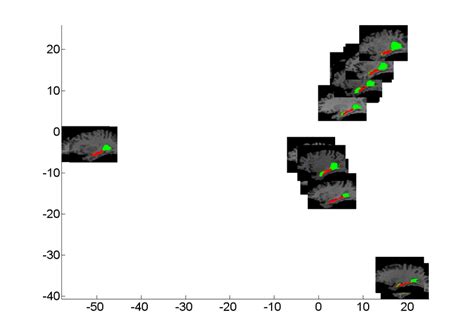 Two Dimensional Embeddings Of Adni Data Based On A Conventional Download Scientific Diagram