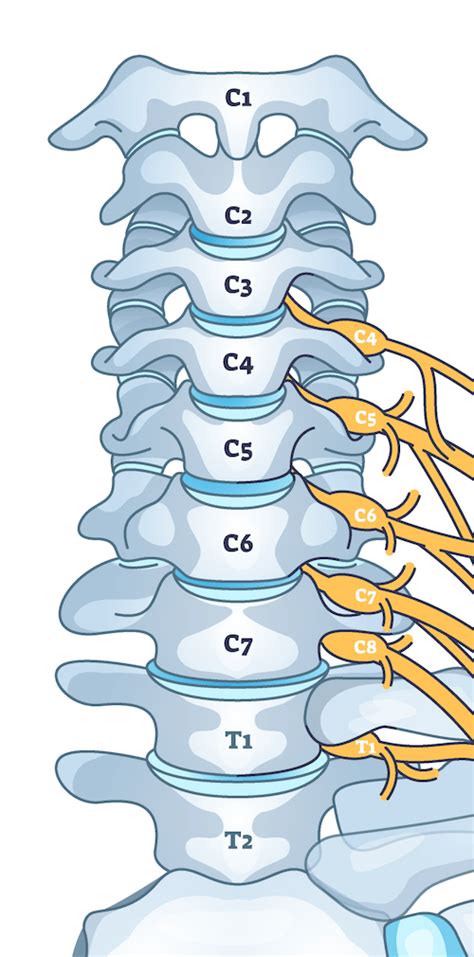 Estudio de Radiculopatía cervical