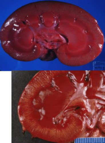 Urinary Pathology 3 Flashcards Quizlet