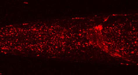How To Kickstart Self Cleaning Mode In Brain Cells Scientists May Have