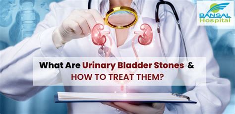 What Are Urinary Bladder Stones And Their Treatments
