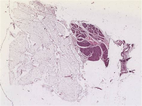 Solved 5 Lactating Mammary Gland Non Lactating Mammary