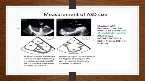 Asd Device Closure Pptx